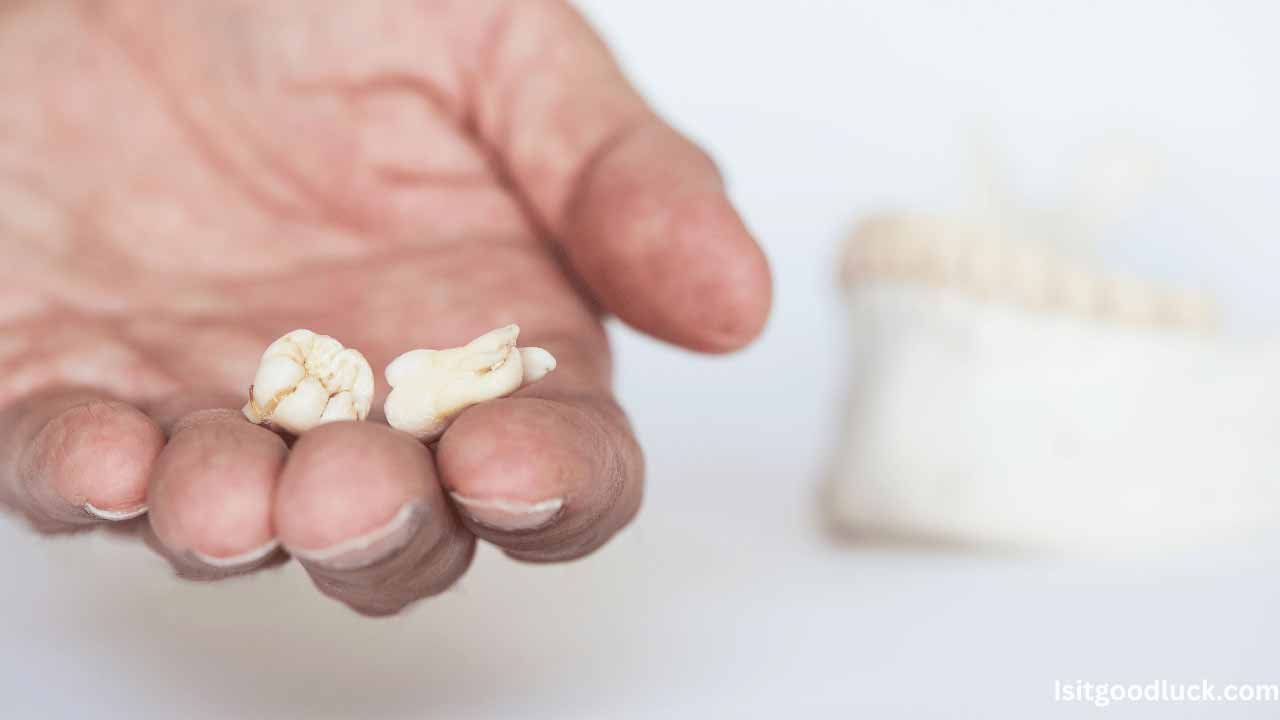 Is it Good Luck to Bury Your Wisdom Teeth? (Answered!) - Good Luck Info